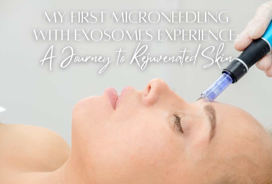 My First Microneedling with Exosomes Experience: A Journey to ...